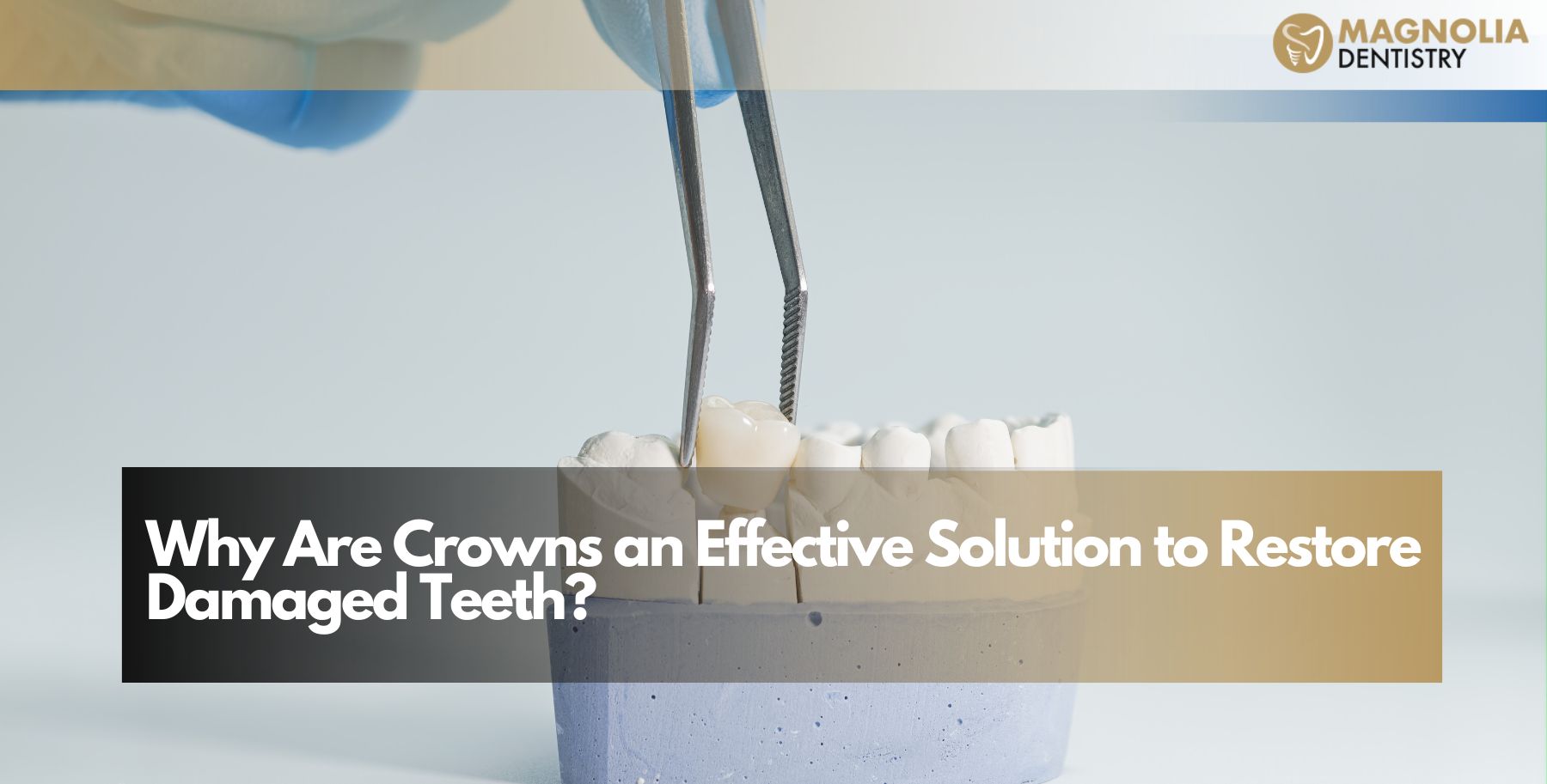 Why Are Crowns an Effective Solution to Restore Damaged Teeth ...