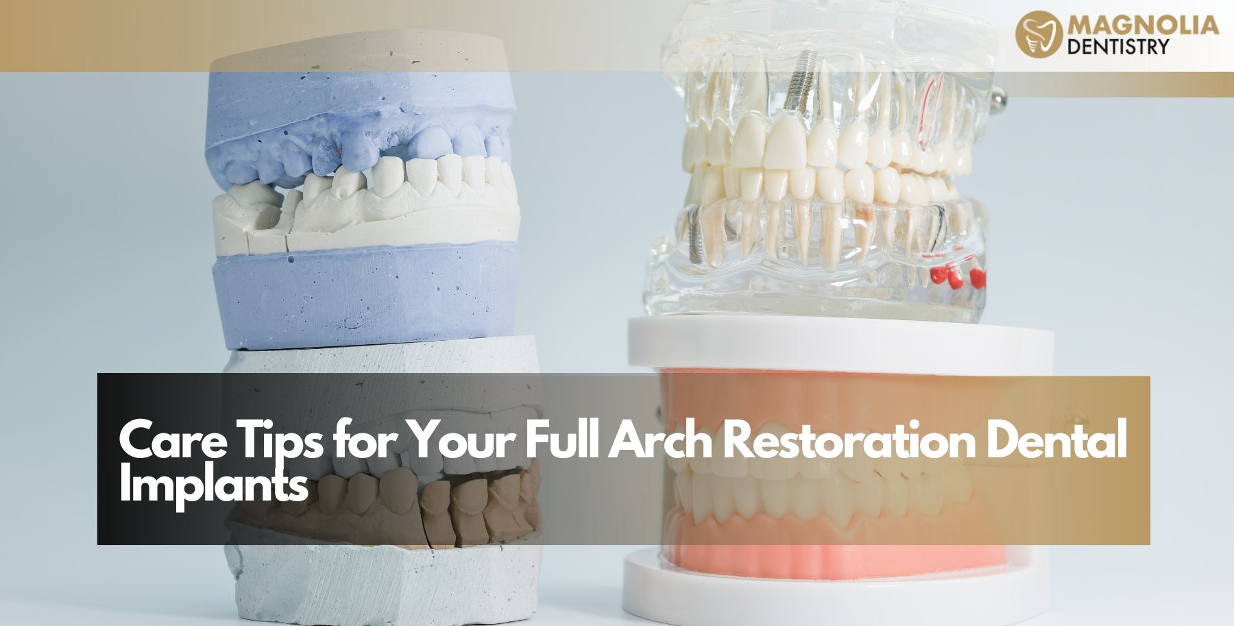Care Tips for Your Full Arch Restoration Dental Implants | Magnolia ...