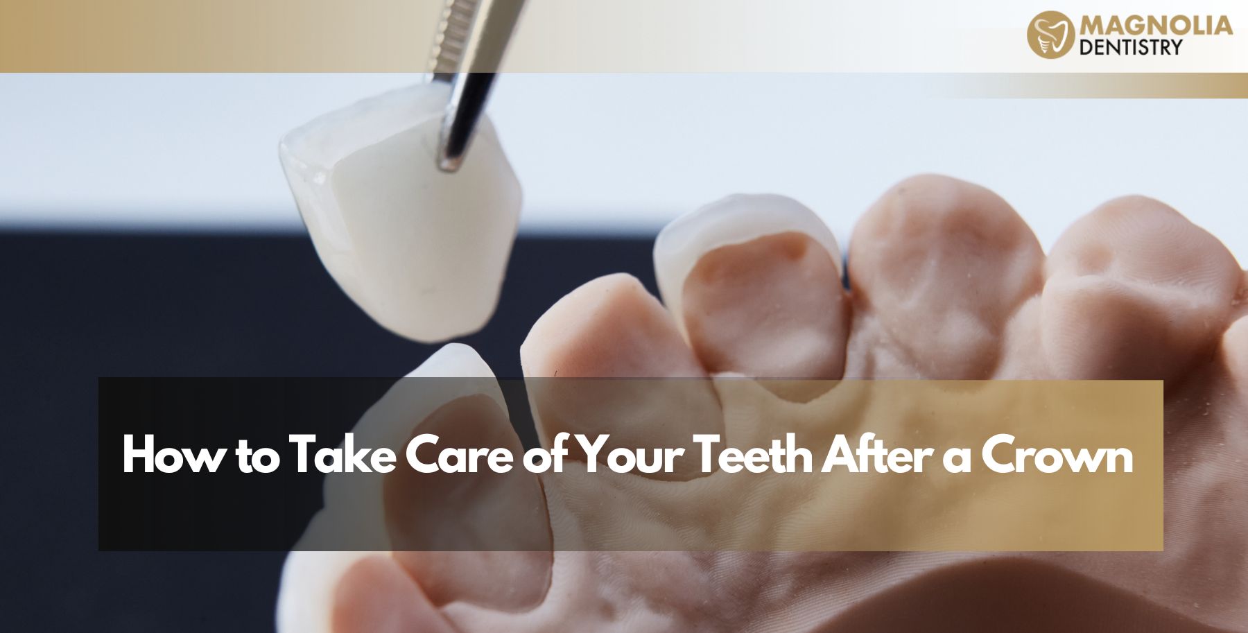How to Take Care of Your Teeth After a Crown | Magnolia Dentistry