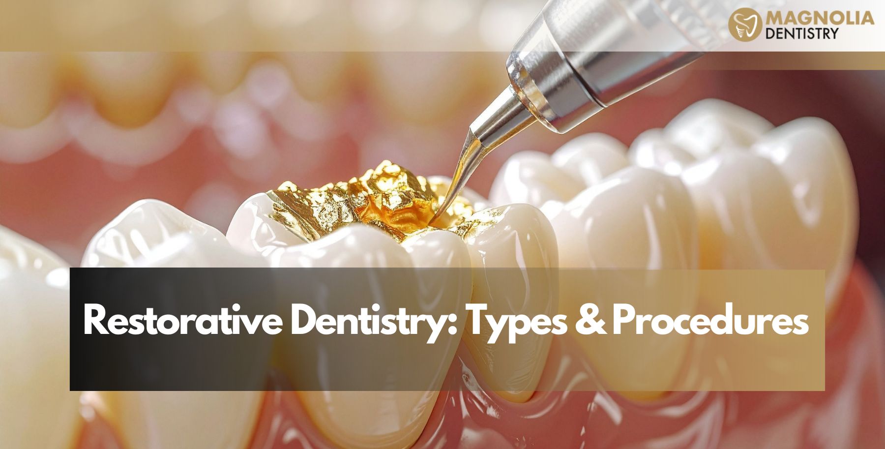Restorative Dentistry: Types & Procedures | Magnolia Dentistry