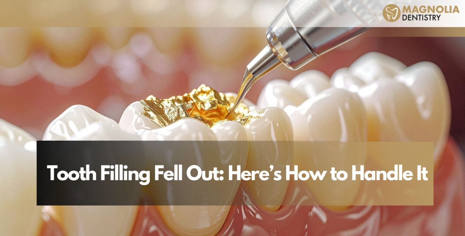 Tooth Filling Fell Out: Here’s How to Handle It | Magnolia Dentistry