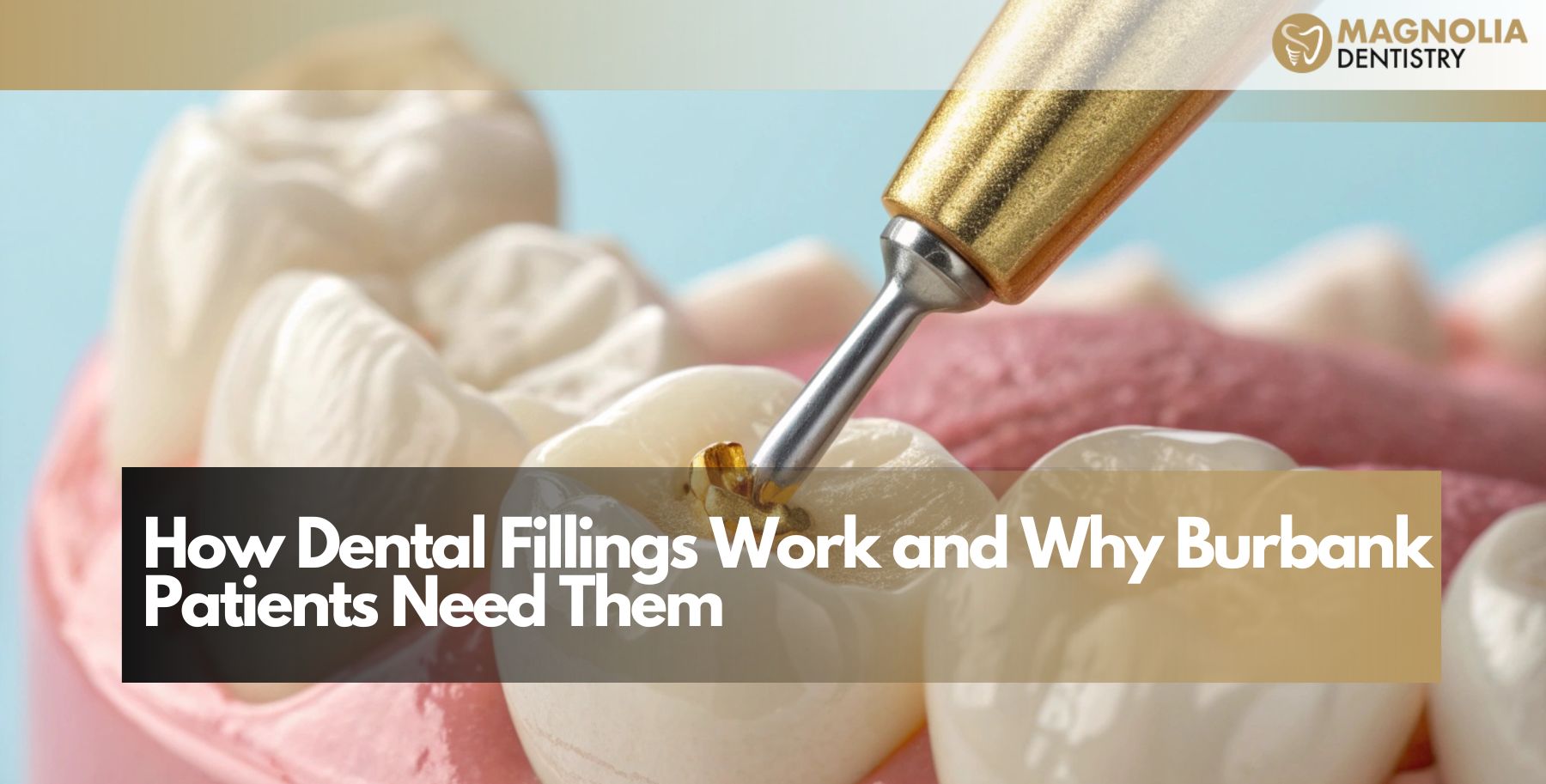 How Dental Fillings Work and Why Burbank Patients Need Them | Magnolia ...