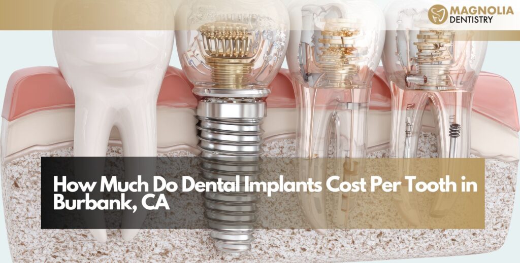 How Much Do Dental Implants Cost Per Tooth in Burbank, CA | Magnolia ...